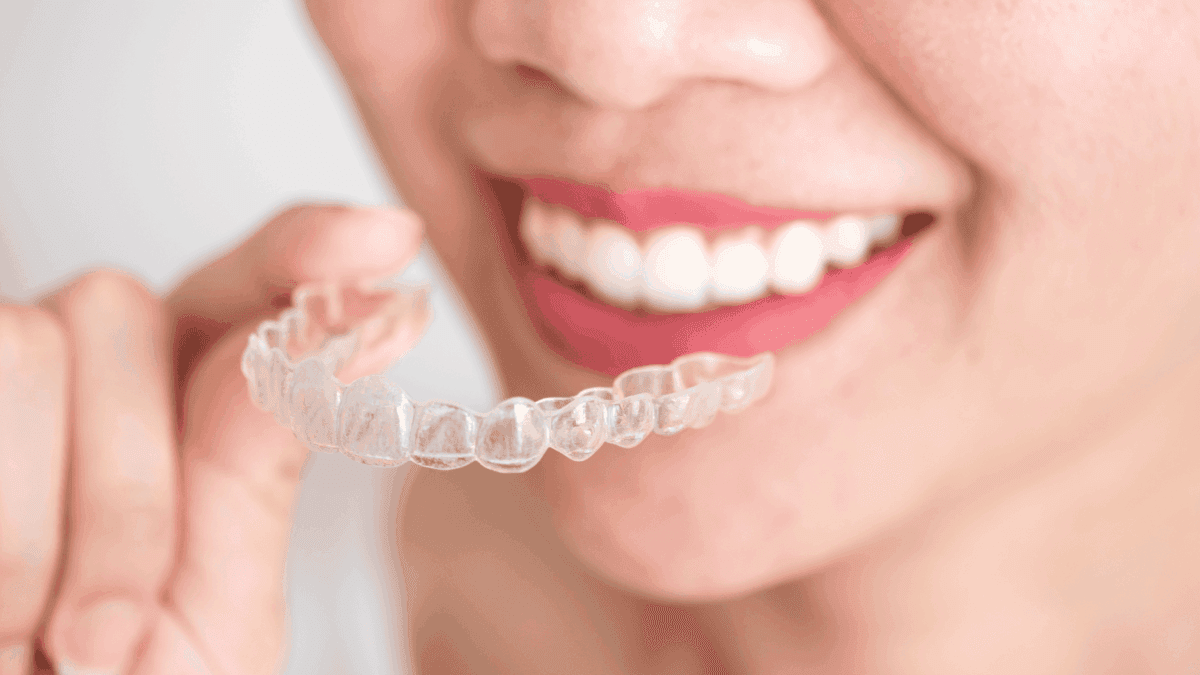 What is the Shortest Timeframe for Invisalign? | Gladwell Orthodontics